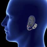 NSS-2 Bridge Device - The-NAD-MD